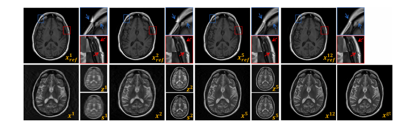 用于多模态MRI重建的深度展开网络与空间对齐|文献速递-生成式模型与transformer在医学影像中的应用-CSDN博客