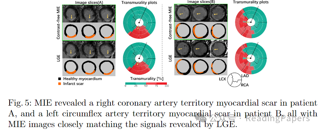 医学顶会 MICCAI‘24 | 知识驱动的扩散模型_miccai myocardial infarction-CSDN博客