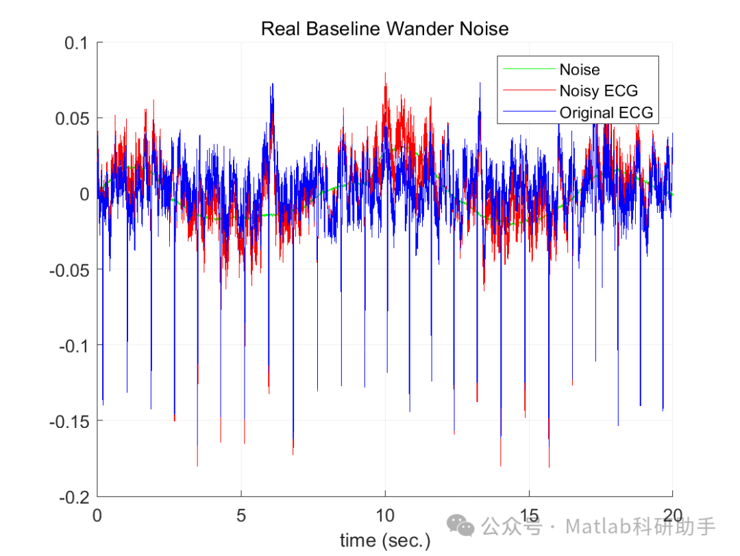 ECG信号处理——包括基本波检测、信号去噪、信号重建度量附Matlab代码_matlab ecg数据-CSDN博客