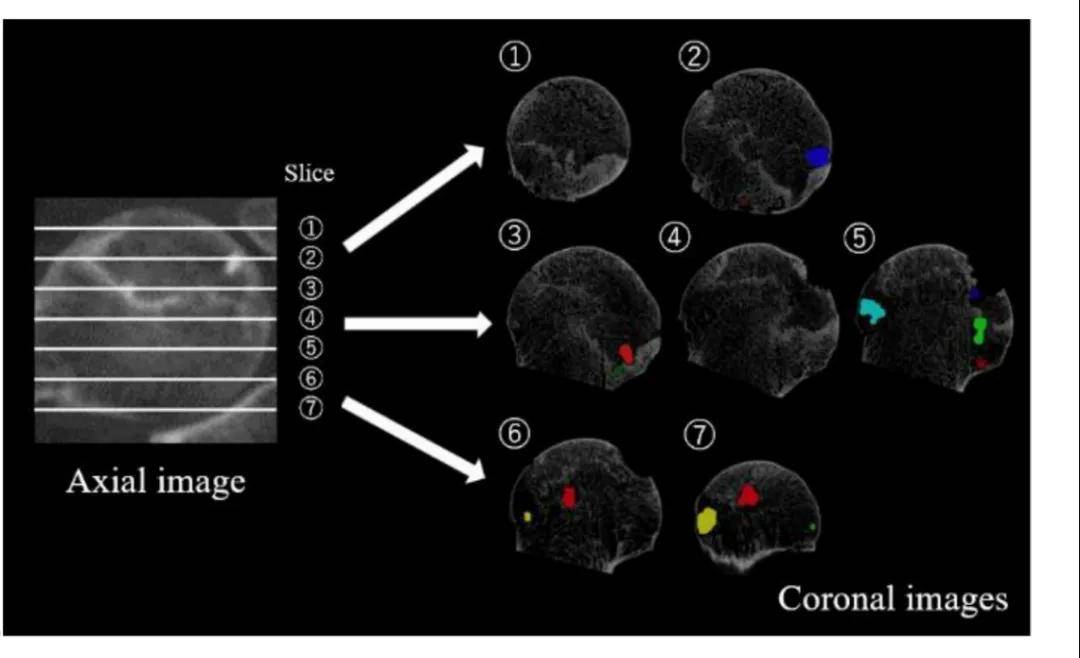 生物测试：Micro-CT深入解析_股骨microct有限元分析-CSDN博客