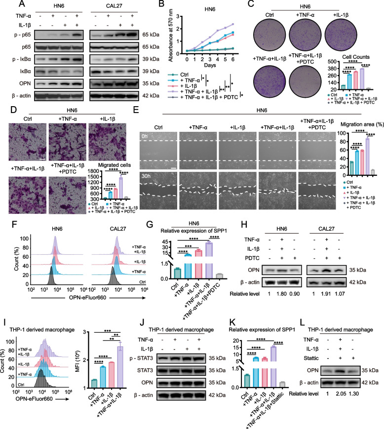 SPP1+巨噬细胞通过分泌TNF-α和IL-1β促进头颈部鳞状细胞癌进展-CSDN博客
