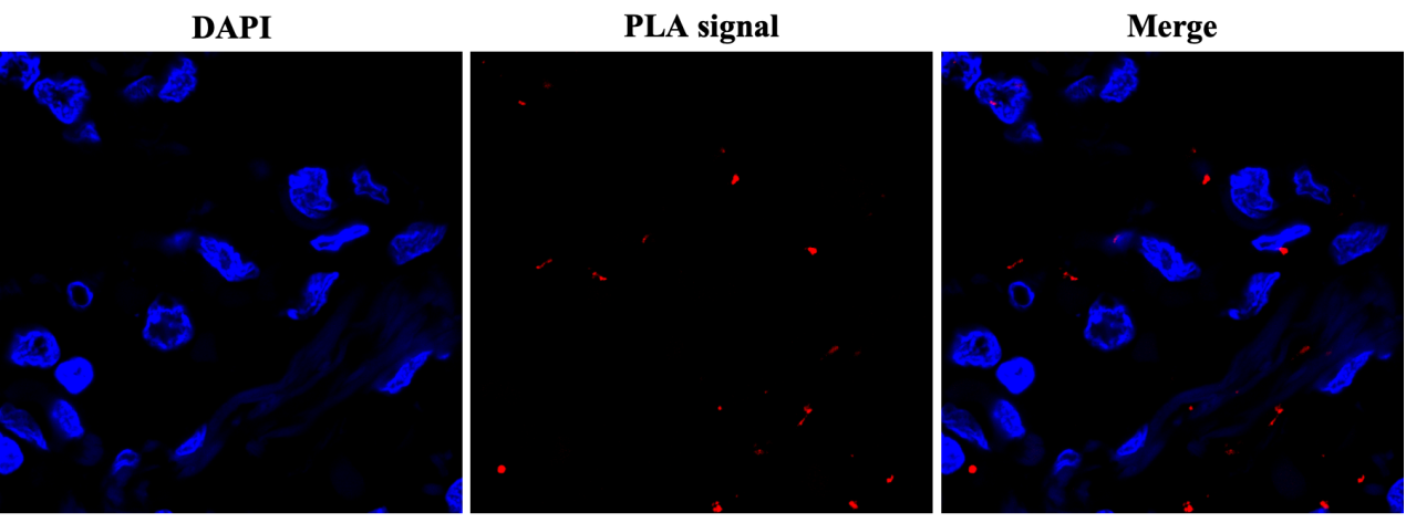 邻近连接（PLA）-CSDN博客