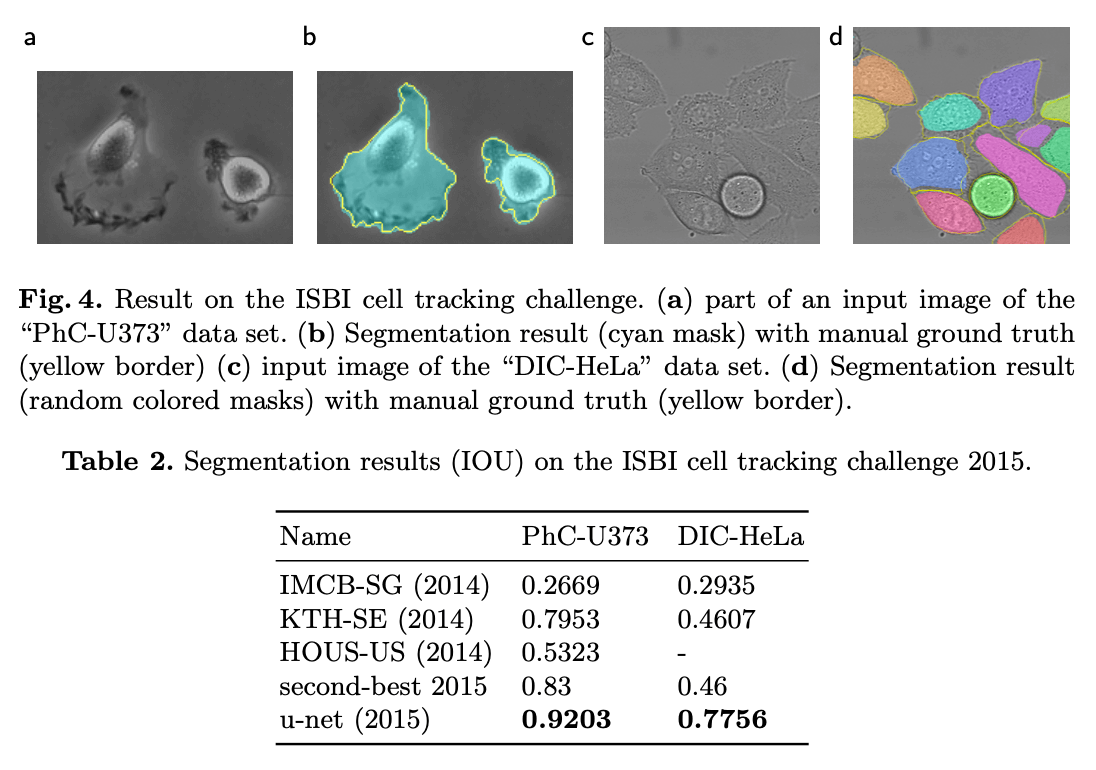 【论文阅读】U-Net：Convolutional Networks for Biomedical Image Segmentation_《u-net: convolutional ...