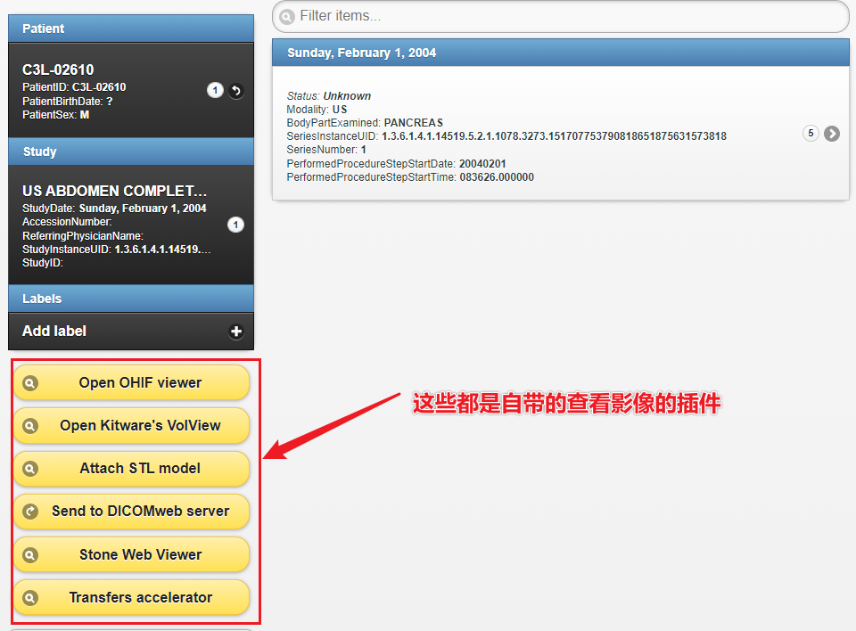 开源影像服务Orthanc docker部署和OHIF Viewer查看，无需访问docker官方镜像源，并实现js批量上传dicom文件_ohifviewer怎么配置 orthanc-CSDN博客