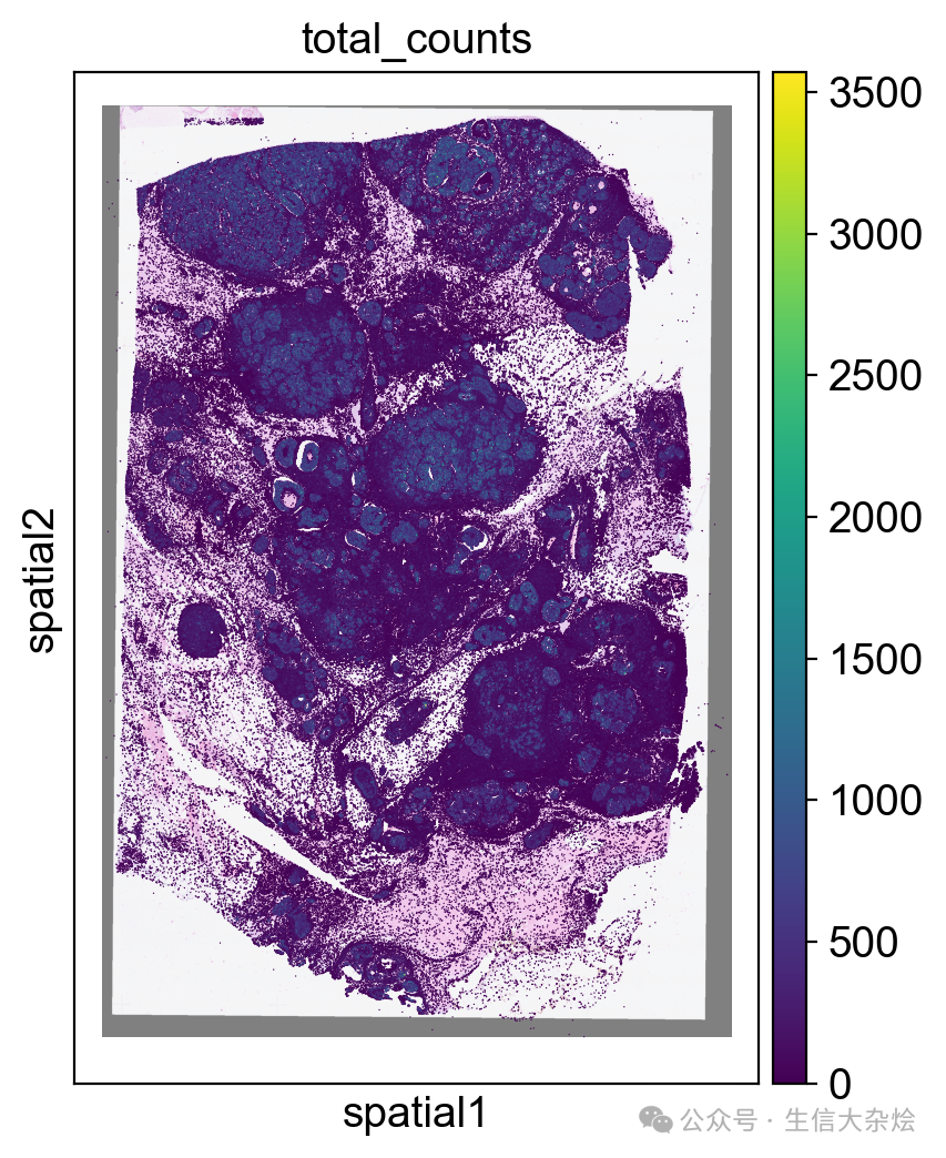 SpatialData：空间组学数据的统一框架与Xenium5k下机数据读取实战_数据组学-CSDN博客
