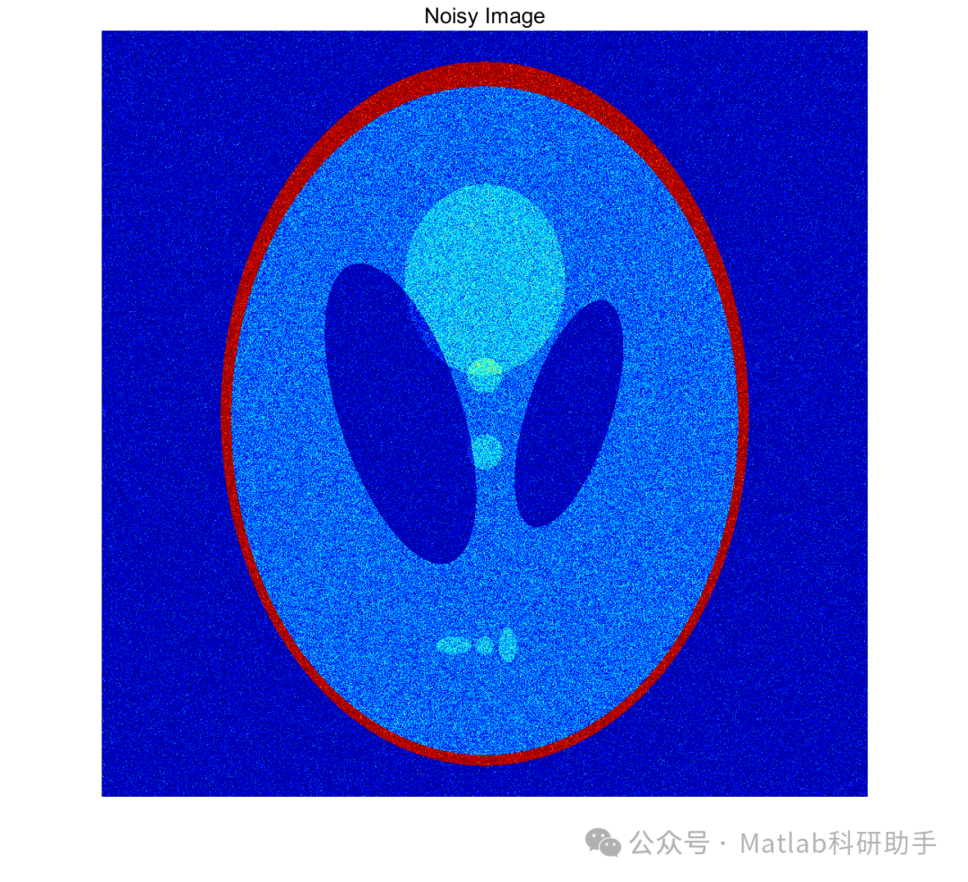 L1正则化问题的分裂Bregman方法附Matlab代码-CSDN博客