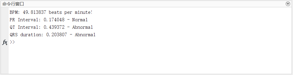 【心电信号ECG】心电图ECG心率监测器（含PR QT QRS）附Matlab代码-CSDN博客