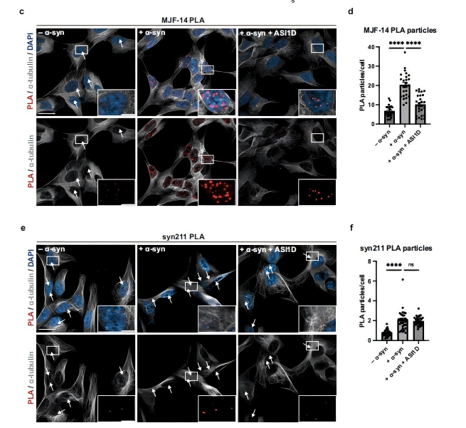【技术应用】邻近连接技术（PLA）解锁帕金森病早期病理_邻近连接实验ipa-CSDN博客