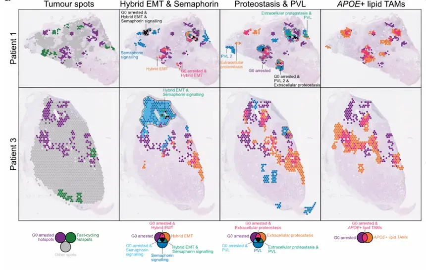 空转复习---空间转录组hotspot_spottedpy-CSDN博客