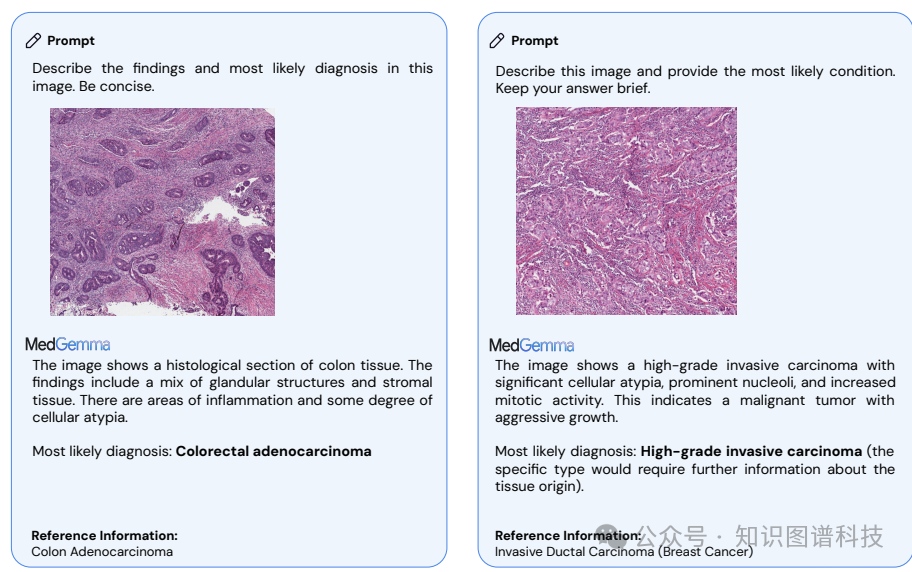 谷歌DeepMind重磅发布多模态医疗AI大模型MedGemma技术报告：下一代赋能医疗文本与影像分析的前沿大模型-CSDN博客