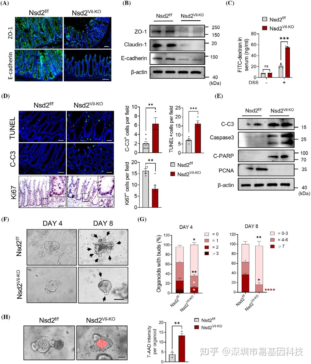 易基因：CTM：ChIP-seq揭示组蛋白甲基转移酶NSD2在炎症性肠病(IBD)发生过程中的表观调控机制_ibd 免疫细胞染色-CSDN博客