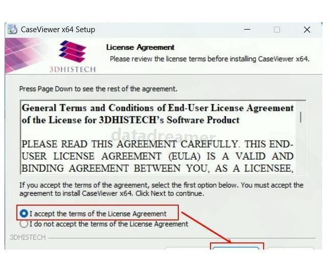 caseviewer软件安装步骤（附安装包）CaseViewer 2.4 超详细下载安装教程-CSDN博客