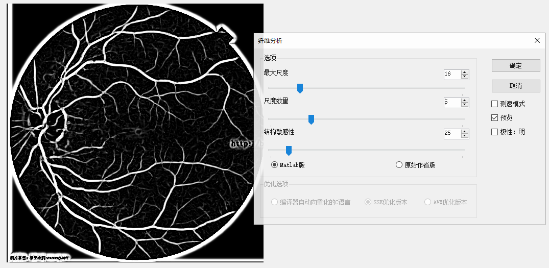 【工程应用十】 基于Hessian矩阵的Frangi滤波算法 == 血管图像增强 == Matlab中fibermetric函数的自我实现 ...