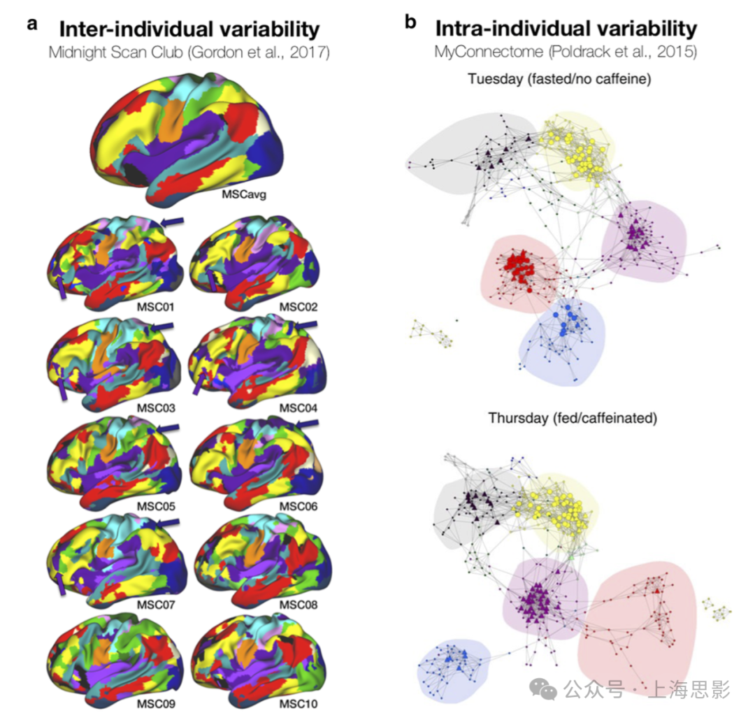 利用开放的神经影像数据集来理解大脑_ppmi数据集-CSDN博客