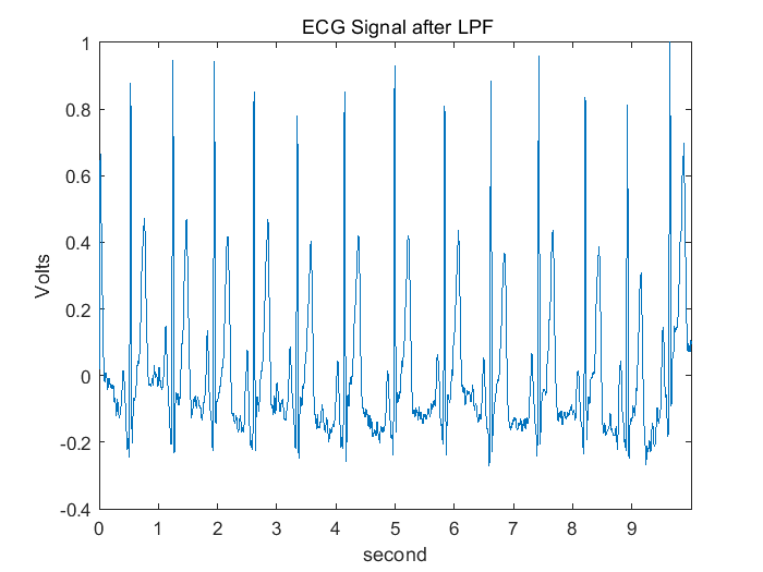 【心率检测】 心电信号（ECG）处理从原始 ECG 数据中提取 R 波峰值、计算心率（HR）与心率变异性（HRV）Matlab代码-CSDN博客