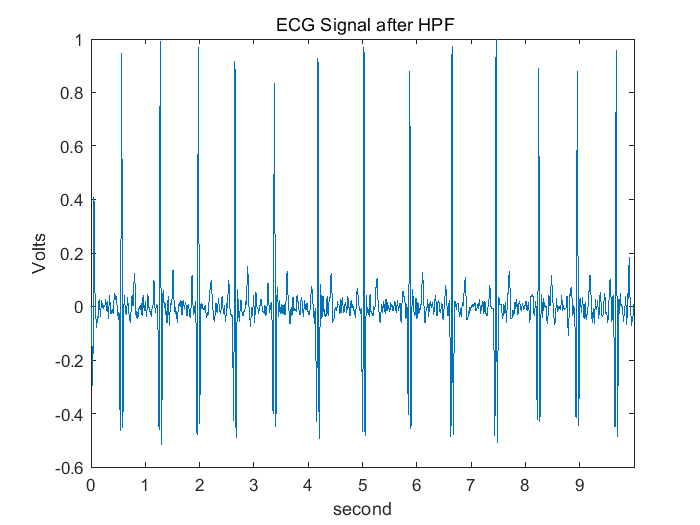 【心率检测】 心电信号（ECG）处理从原始 ECG 数据中提取 R 波峰值、计算心率（HR）与心率变异性（HRV）Matlab代码-CSDN博客