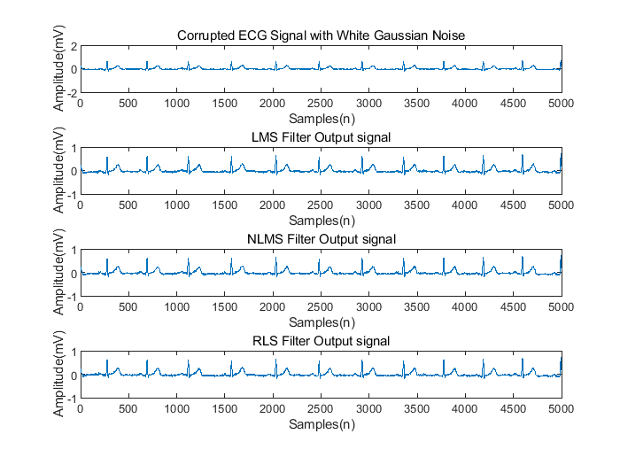 【ECG心电信号】基于LMS、NLMS和RLS算法自适应过滤被静止噪声和非平稳噪声破坏ECG信号去噪附Matlab代码_ecg自适应滤波算法-CSDN博客