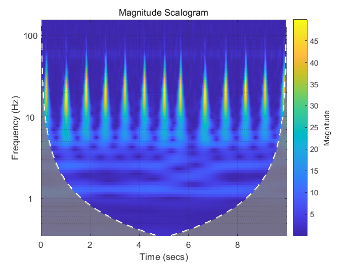 【ECG心电信号】基于HHTransform分析心电图信号附Matlab代码-CSDN博客