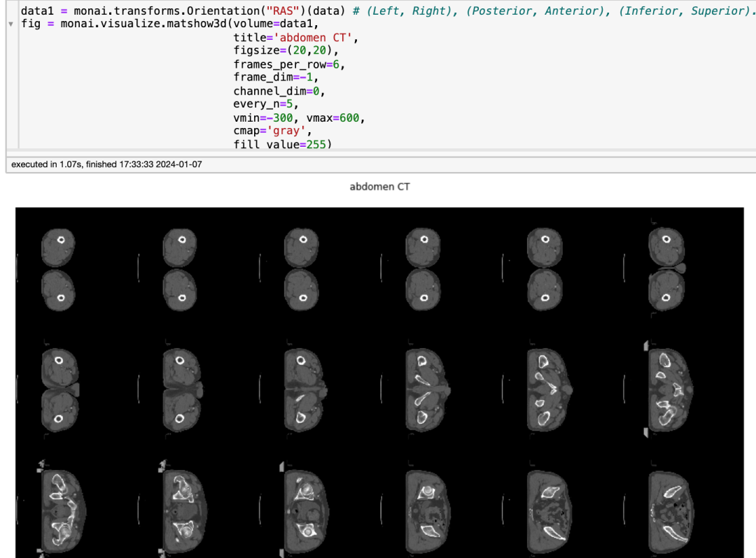 如何用python显示3D医学图像？MONAI这个功能太好用~_python monai-CSDN博客