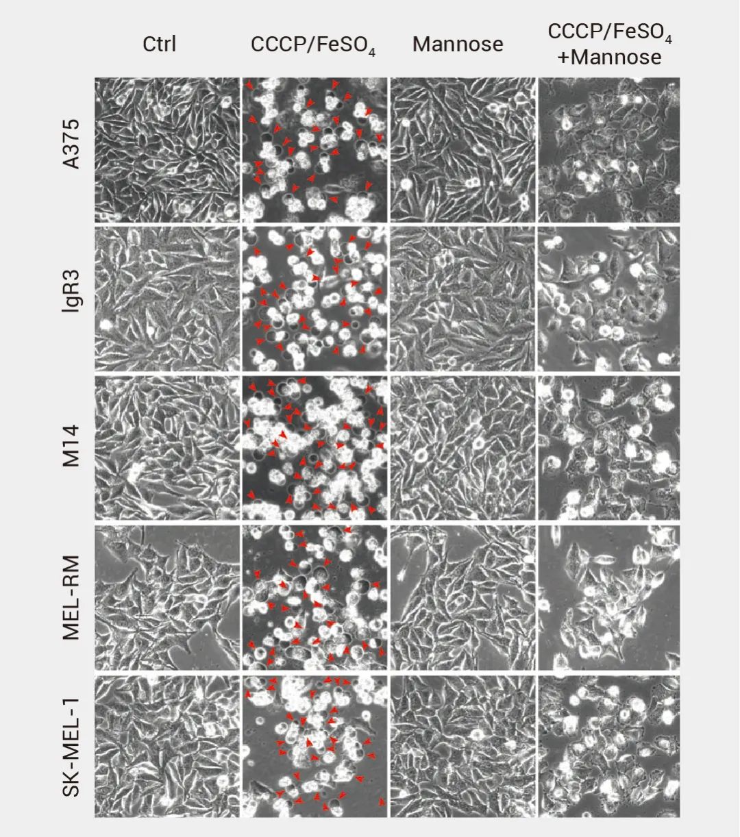 细胞的第 N 种死法：细胞焦亡！ | MedChemExpress (MCE)_细胞焦亡 肿瘤胞内菌-CSDN博客