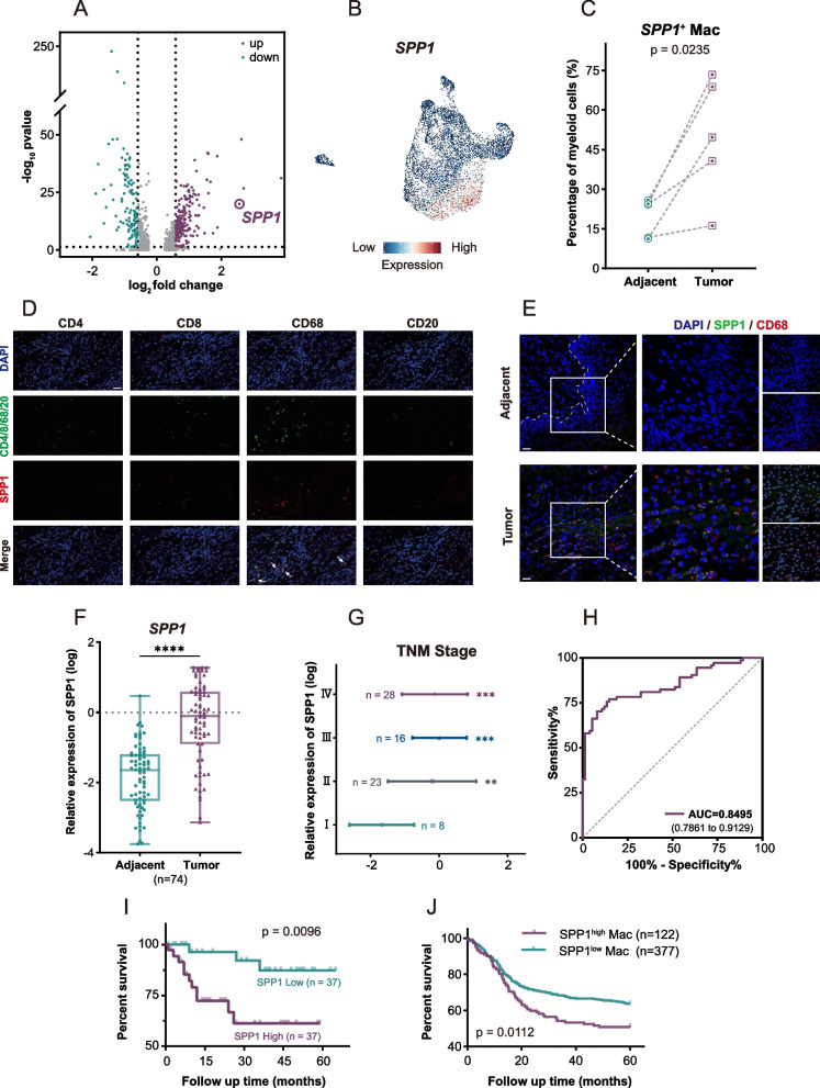 SPP1+巨噬细胞通过分泌TNF-α和IL-1β促进头颈部鳞状细胞癌进展-CSDN博客