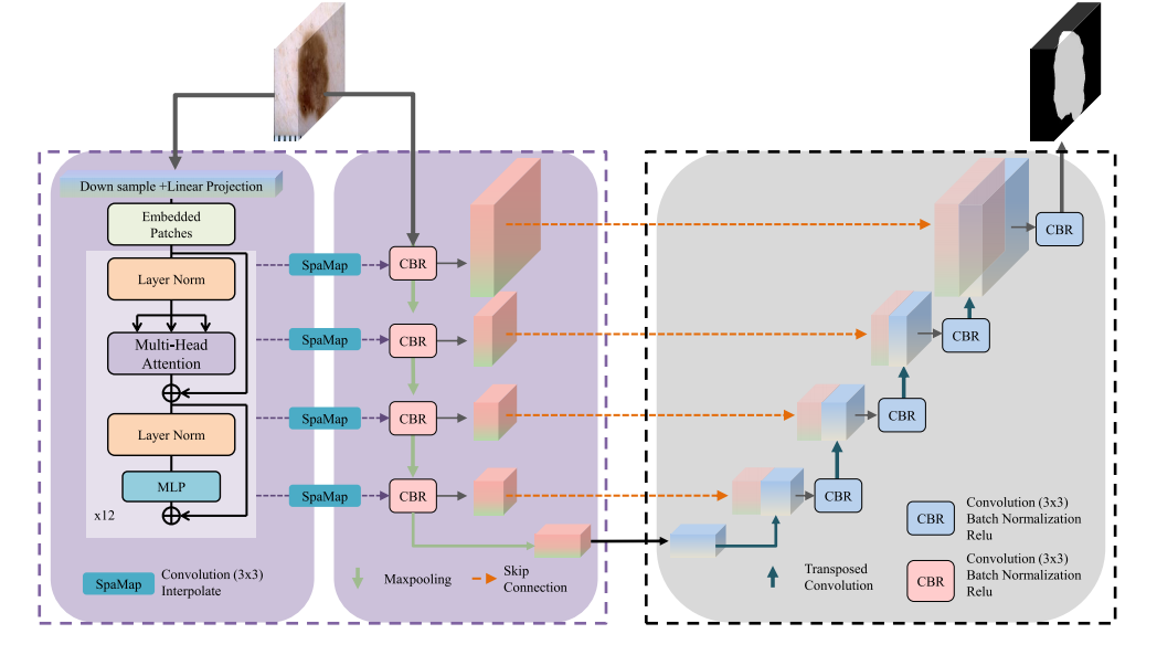 UNet+注意力机制双结合速度狂提98.82％！起步发一区！_attention unet的dice系数-CSDN博客