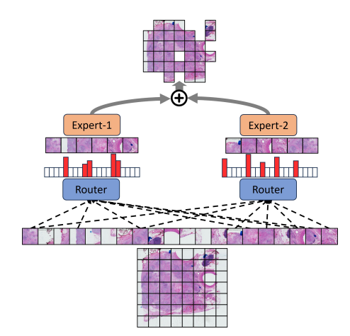 【AI+医疗】大模型新视角：MoE专家混合模型在医学影像分析中的创新应用！_cvpr2025 mixture-of-experts-CSDN博客